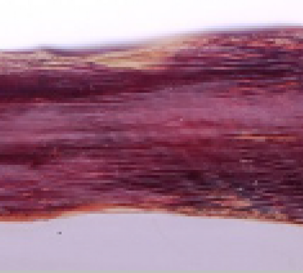 Esófago | DAYBELLE S.A.S.| Colombian B2B Marketplace